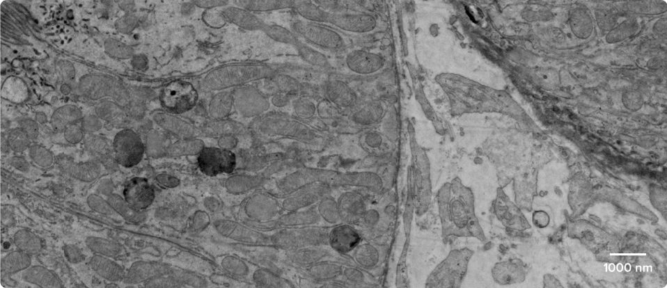 FAST-EM | Ultra-fast automated multibeam electron microscope